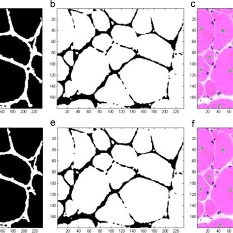 Example Of Case 1 Based On The State Of Art Threshold Selection Methods Download Scientific