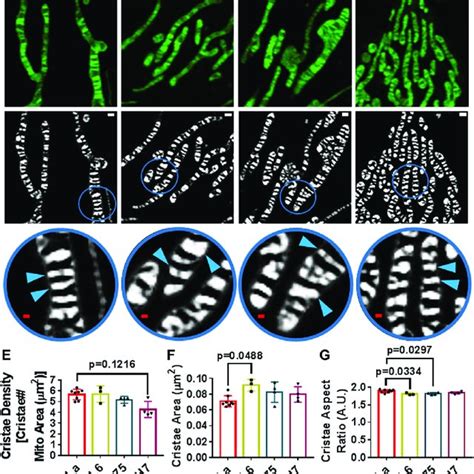 Trainable Weka Segmentation Protocol Enables Segmentation Of Cristae In