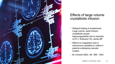 Crystalloids Iv Fluids Management Anaesthesia Ppt Free Download
