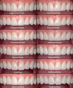 Smile Guide Iverson Dental Labs