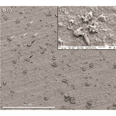 Scanning Electron Micrographs Of Platelet Morphologies After 1 Hour