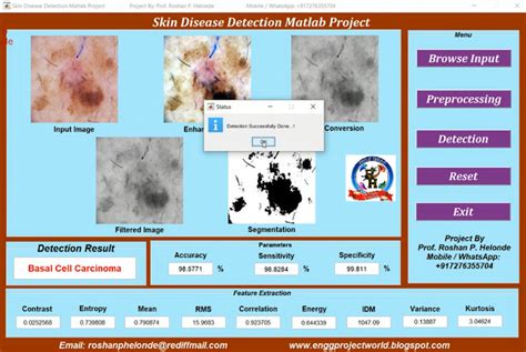 Type Of Skin Disease Detection Using Image Processing Matlab Project