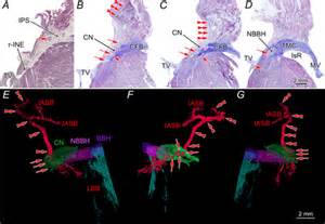 Anatomical Characterisation Of An Additional Atrioventricular Node