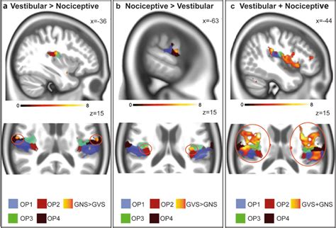 Responses In The Parietal Operculum During The Different Tasks