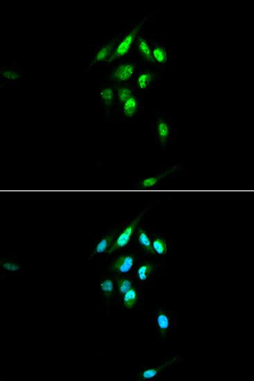 Glucocorticoid Receptor Rabbit Pab Polyclonal Antibodies Abclonal