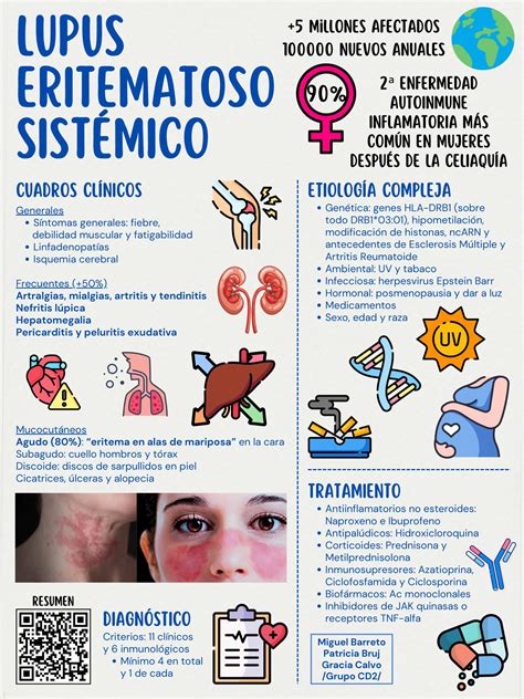 Lupus Eritematoso Sistémico Immunomedia