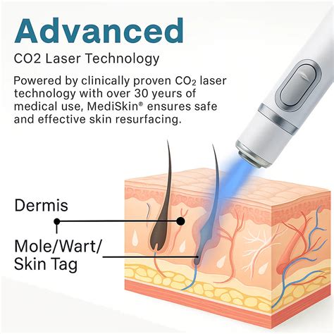 Mediskin Laser Koqon