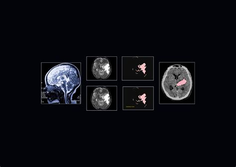 Medical And Healthcare Data Annotation Services In India Pixel Annotation