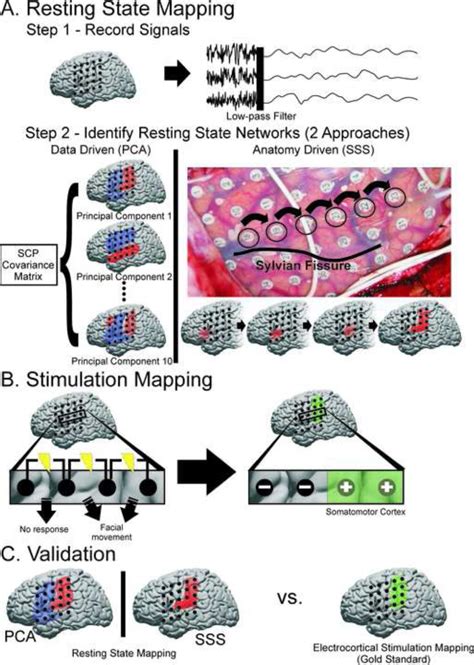 Figure 1 From Mapping Sensorimotor Cortex With Slow Cortical Potential