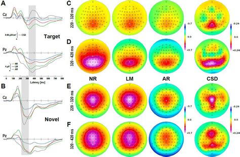 Issues And Considerations For Using The Scalp Surface Laplacian In Eegerp Research A Tutorial