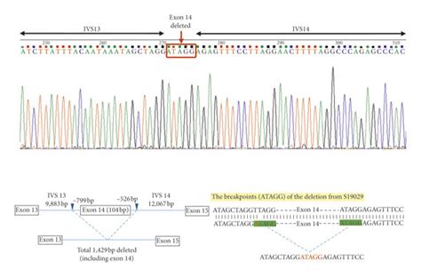 Phex Gene Deletion Around Exon 14 And The Breakpoint Atagg Of The