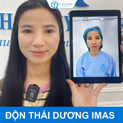 Lưu ý Chăm Sóc Sau Khi độn Thái Dương Imas Dr Trần Quyết