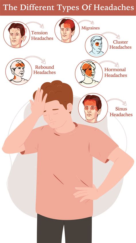 Types Of Headaches Headaches Headachetreatment Headacherelief Neurology Neuroscience Eroppa