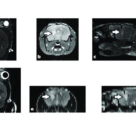 3d Truefisp A B And C And Multi Slice 2d Rare Imaging D E And F