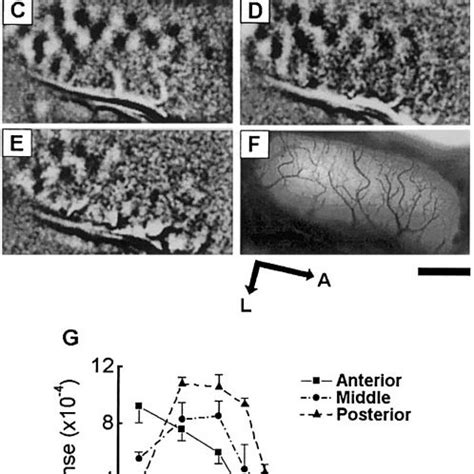 Functional Orientation Maps In The Visual Cortex Elicited By Various Download Scientific
