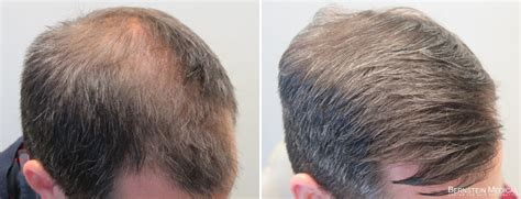 Medical Treatment Before And After Photos