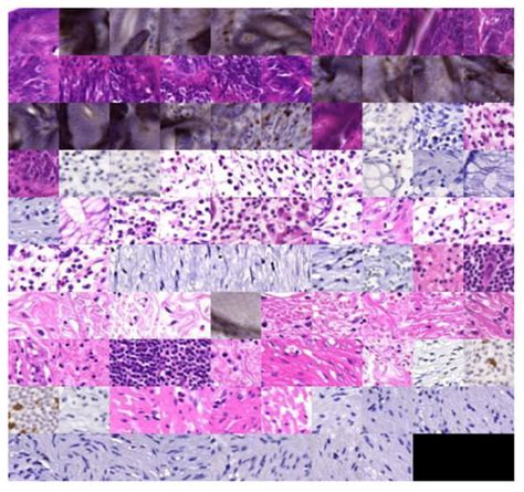 Disentangled Autoencoder For Cross Stain Feature Extraction In Pathology Image Analysis