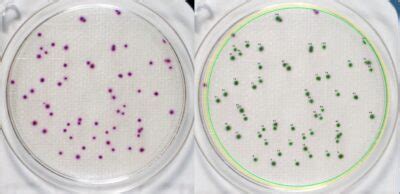 How To Count Bacterial Colonies On Agar Plate