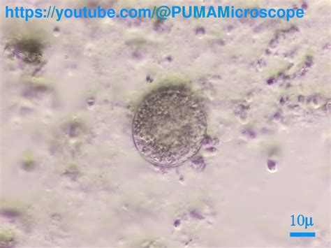 Paul Tadrous On Linkedin Opensource Microscope 3dprinted