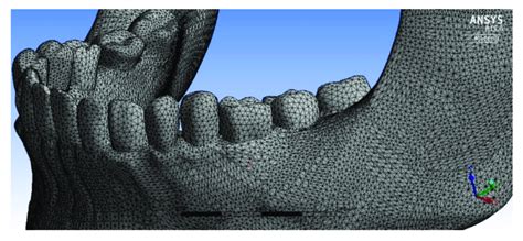 The Mandible Models Tetrahedral Finite Element Network Download