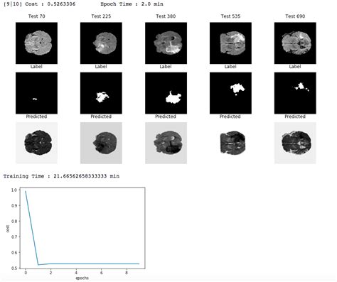 Python Tensorflow For Image Segmentation Changing Minibatch Size Stops Learning Stack Overflow