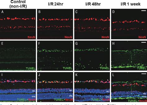 Figure 4 From Retinal Ischemiareperfusion Rat Model With Double