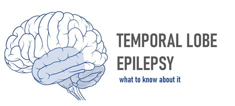 Temporal Lobe Epilepsy – What to Know About It?