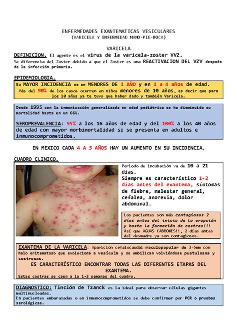 Enfermedades Vesiculares Enfermedades Exantematicas Vesiculares