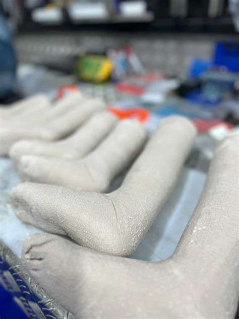 Nuestros Trabajos Ortoprotésica Eurodiscap