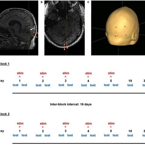Neuronavigation And Study Design Screenshots From The Download