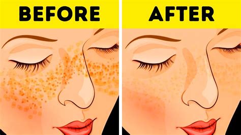 Beauty Hacks Experts Use To Get Rid Of Pores From Their Face Life Hack Solution