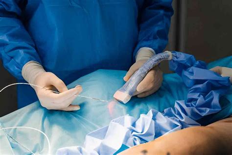 Effective Varicose Vein Treatment In Bangalore Kauvery Hospital