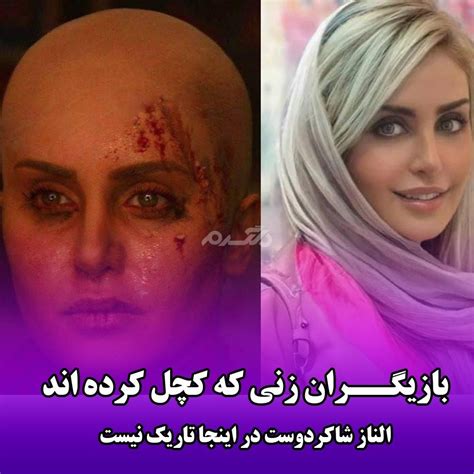 چهره بسیار زیبای بازیگران زن با موی تراشیده و سر کچل زیباتر از همیشه