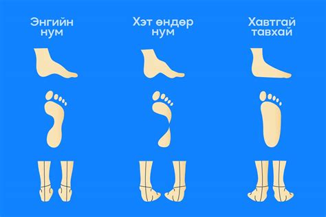 Japan Хөлний нум засах хэрэгсэл нь нумгүй хөлтөй эсвэл хэт их нумтай