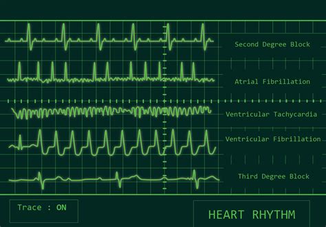 Heart Rhythm Vector Pack 161550 Vector Art At Vecteezy