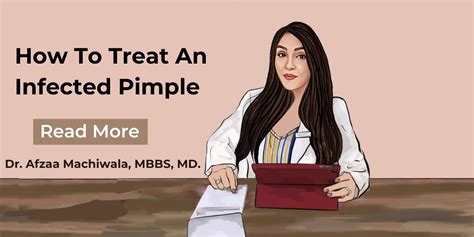 How To Treat An Infected Pimple Sutvakclinic