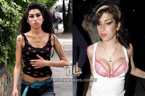 Famosas Que Se Operaron Los Senos Antes Y Despues