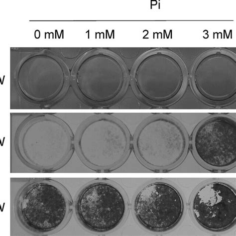 Effect Of Phosphate On Mineralized Nodule Formation By Svf4 Cells Download Scientific Diagram