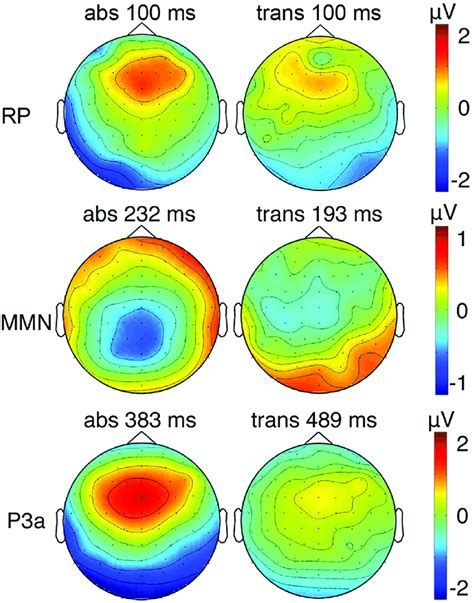 Scalp Maps Showing Rp Mmn And P3a Component Distribution Scalp Maps
