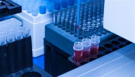 The Importance Of Reagent Preparation Systems Blogging Hub