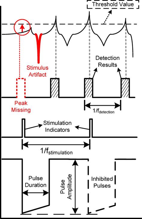 Operation Of The Proposed Imsoc And The Stimulation Parameters