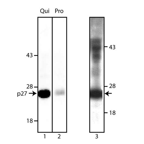 Purified Mouse Anti P27 [kip1]