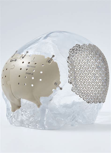 Titanium Mesh Pt Accurate Medica Solutions