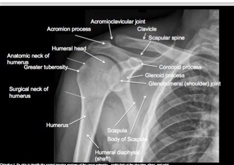 Ap Ext Shoulder Labeling Diagram Quizlet