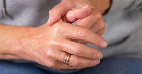 8 Early Signs Of High Uric Acid In The Body