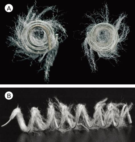 A Photograph Showing A Platinum Coil With Synthetic Fiber Coated