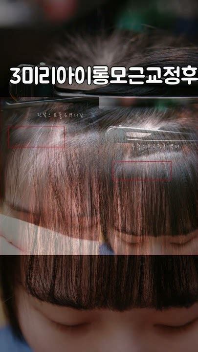 앞머리뿌리교정 모근교정 3미리아이롱뿌리교정 아이롱펌 아이롱앞머리뿌리 Youtube