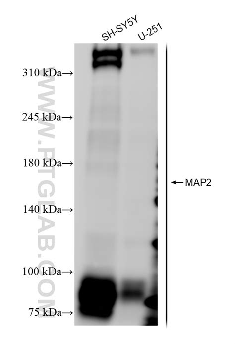 Map2 Antibody 84306 4 Rr Proteintech