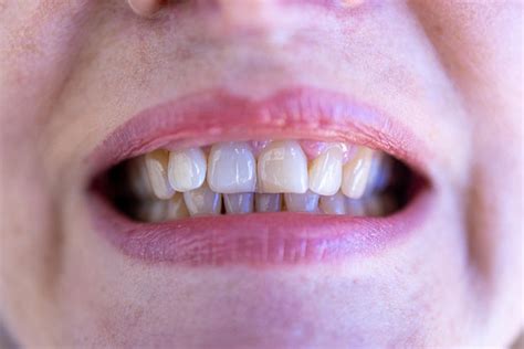 Teeth Mouth Face - Free photo on Pixabay - Pixabay