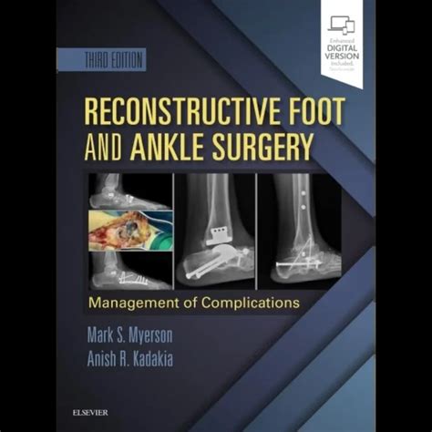 Reconstructive Foot And Ankle Surgery Management Of Complications Flex Orth